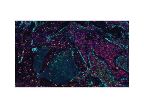 Single-Cell, Spatial Analysis - ILC